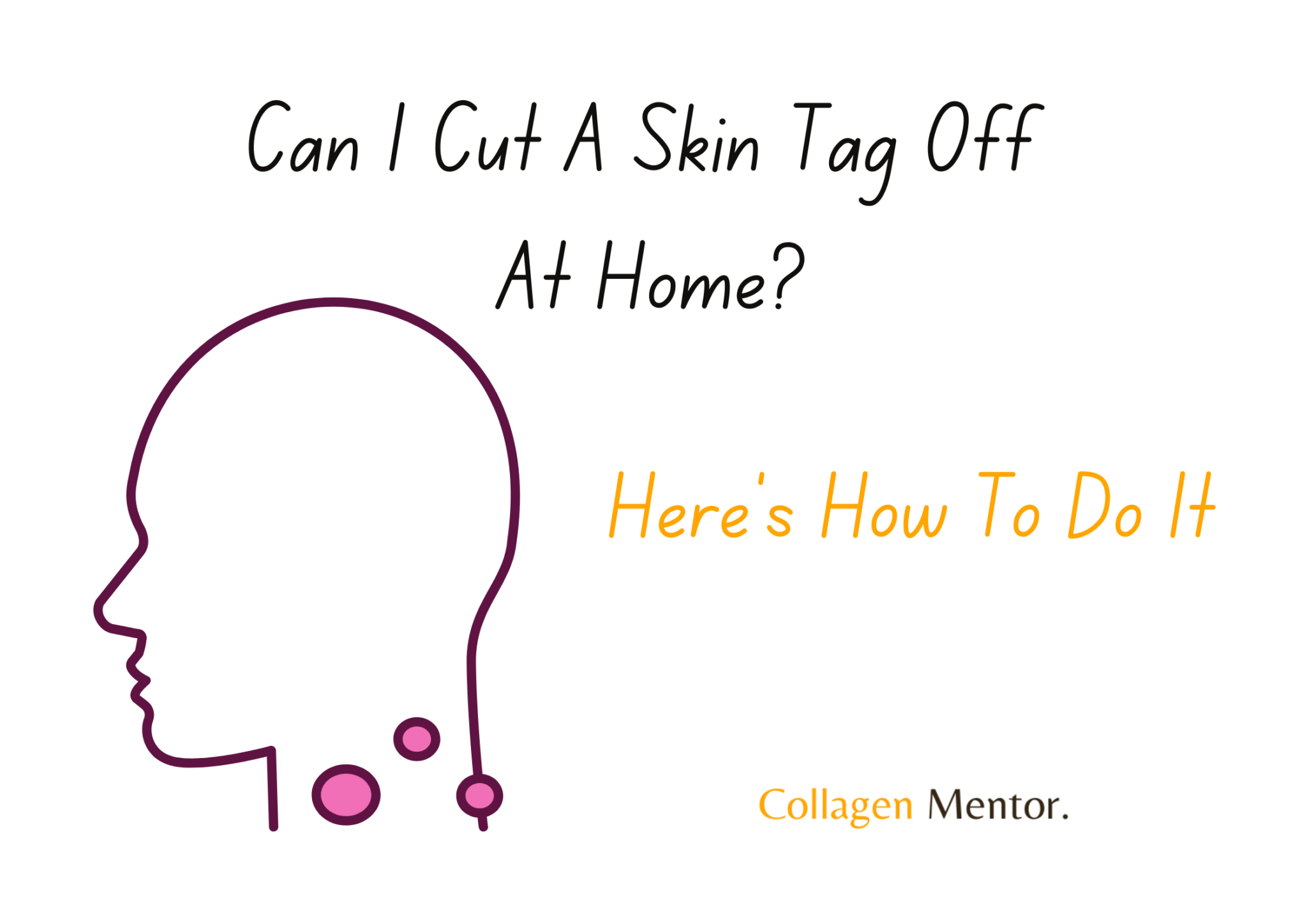 Can I Cut A Skin Tag Off At Home? Here's How To Do It - Collagen Mentor